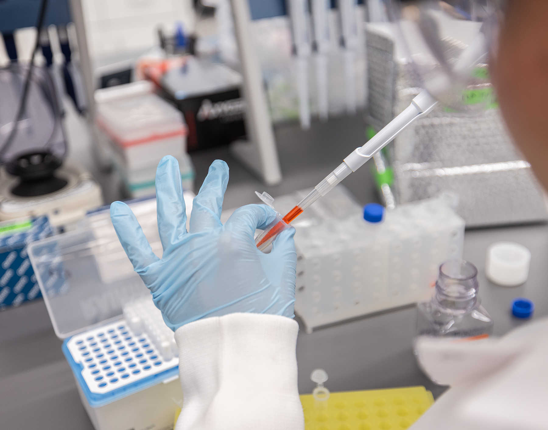 DOS Research Aims To Improve Breast Cancer Outcomes - Department of Surgery